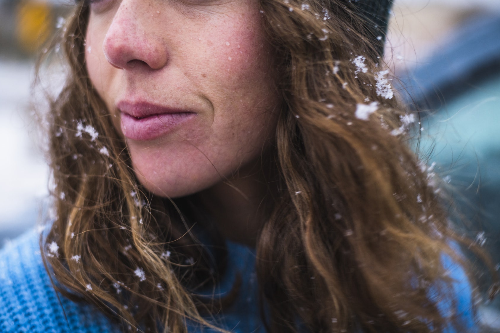 How to Treat Wind Burn on Your Face After a Cold, Wintery Outdoor ...