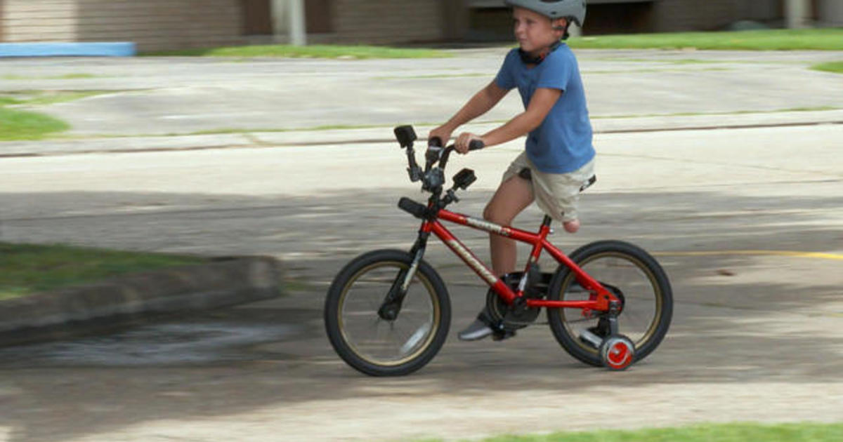 Teen Robotics Team's invention helps boy with a prosthetic leg ride a ...